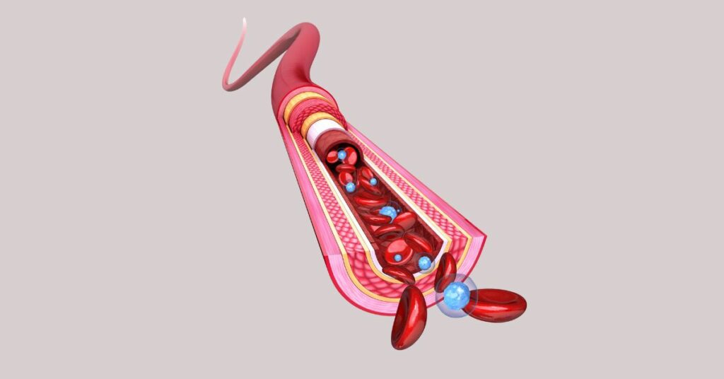 What is Chelation Therapy? - Tringali Vibrant Health