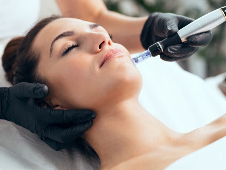 Plant Exosomes Microneedling - Tringali Vibrant Health